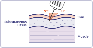 About ZILBRYSQ® (zilucoplan) Injection Self-Administration